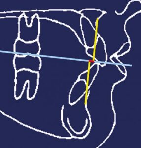 KFO Kompetenz - Ihr Partner für Digitale Kieferorthopädie