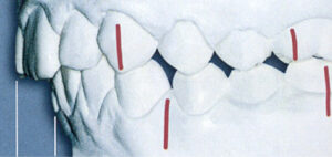 KFO Kompetenz - Ihr Partner für Digitale Kieferorthopädie